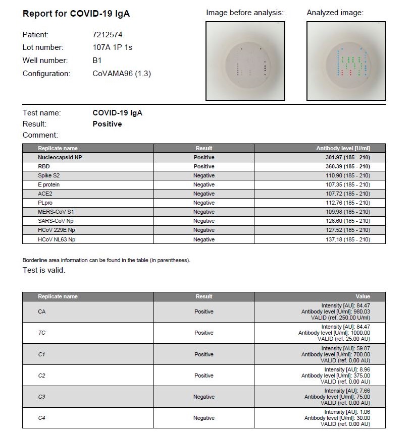 Microblot-Array (MBA) | TestLine Clinical Diagnostics s.r.o.